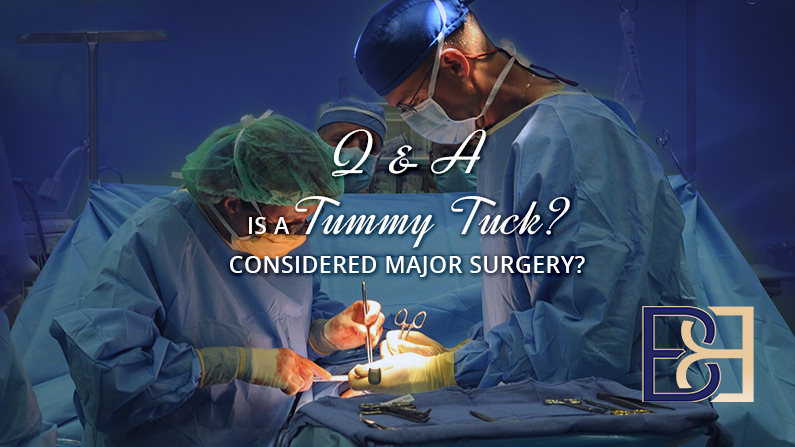 Is an Abdominoplasty Major Surgery?