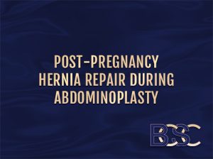 Fleur-de-Lis Abdominoplasty Surgery Guide