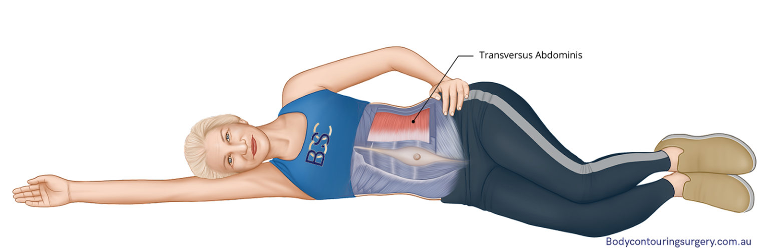 How to Tell if Your Abdominal Muscles Were Torn During Pregnancy