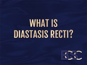 Diastasis recti Archives - Body Contouring Surgery