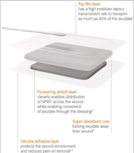 Using PICO Negative Pressure Dressings for Abdominoplasty Incision